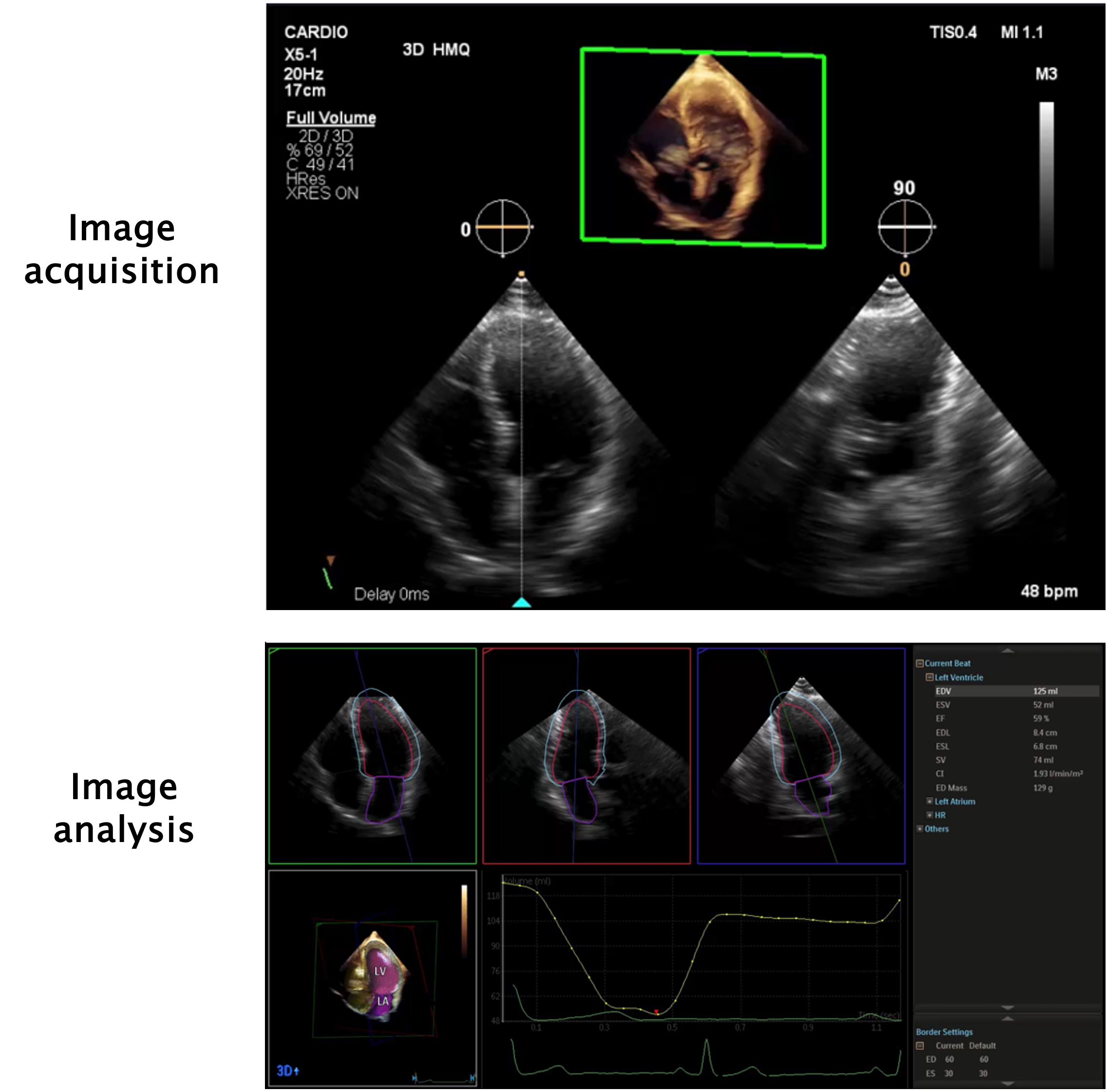 Artificial intelligence in cardiovascular imaging algorithms – what is used in clinical routine?